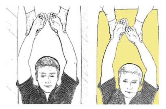 Test Arm Reflex - Kinemociónate